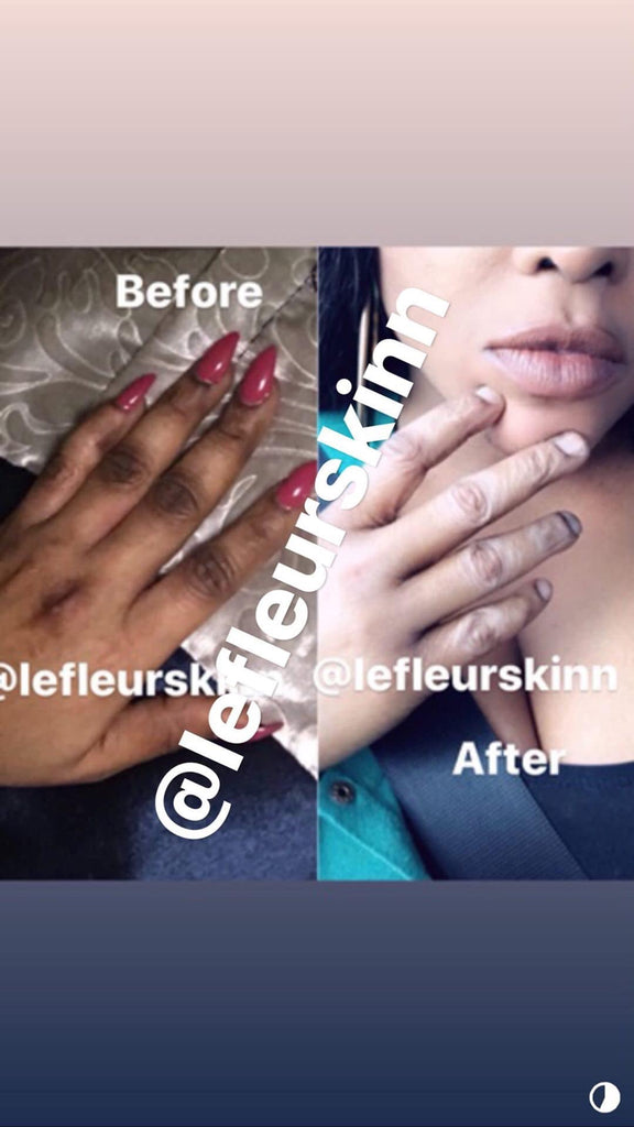 EXTREME DARK KNUCKLE SET - Lefleurskin